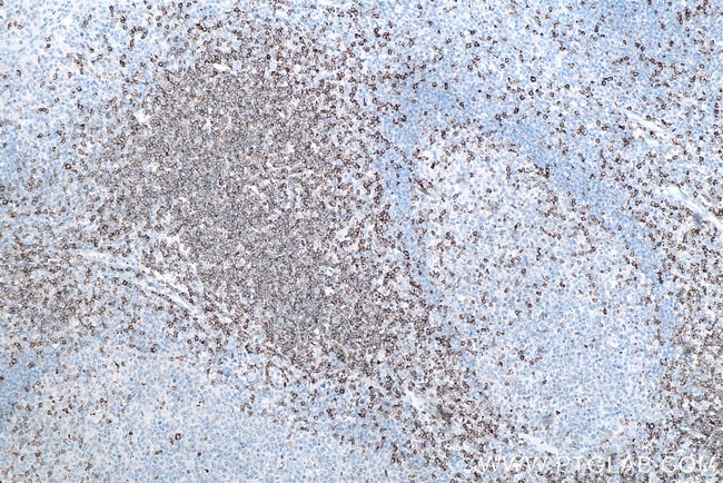 Proteintech IHCeasy CD7 Ready-To-Use IHC Kit 50 Tests Products | Fisher ...