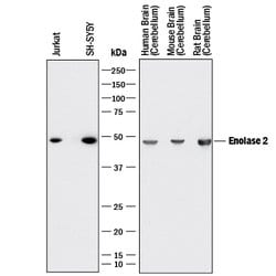 Enolase 2/Neuron-specific Enolase Mouse anti-Human, Clone: 972458, R&D ...