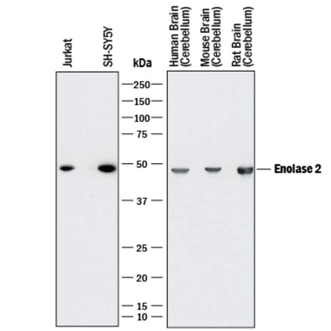 Enolase 2/Neuron-specific Enolase Mouse anti-Human, Clone: 972458, R&D ...