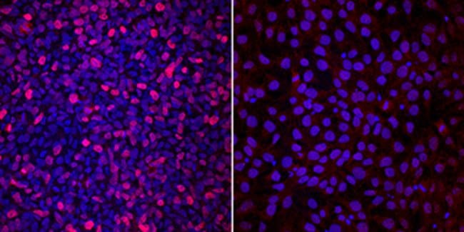 Human TBX6 Antibody, R D Systems 100μg; Unlabeled:Antibodies ...