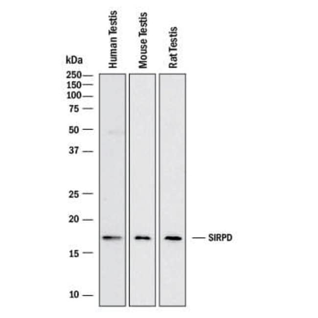 Human/Mouse/Rat SIRP delta Antibody, R D Systems 100 μg; Unconjugated ...