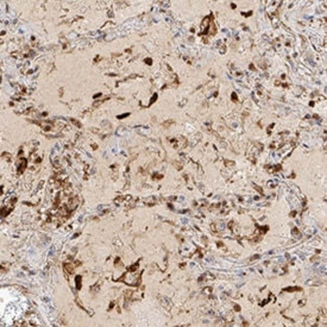 ORF3a Rabbit anti-SARS-CoV-2, Clone: 2819D, R:Antibodies:Primary ...