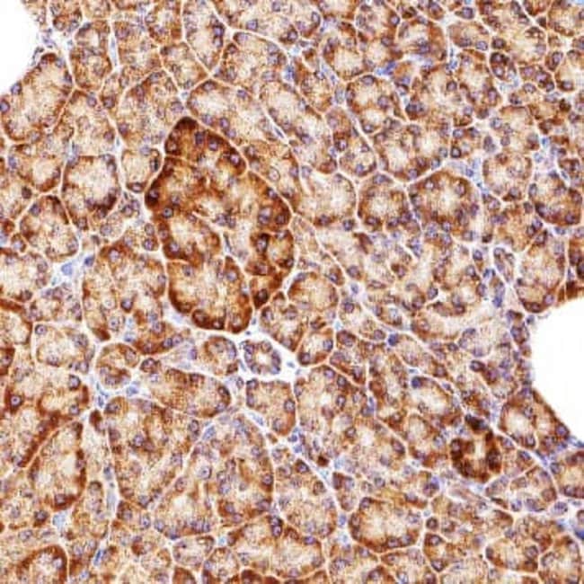 NIK/MAP3K14 Mouse anti-Human, Clone: 603917R, R:Antibodies:Primary ...