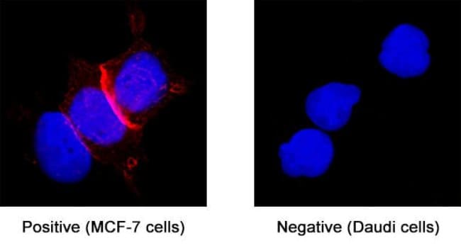 Human L1CAM Antibody, R D Systems 25 μg; Unconjugated:Antibodies ...