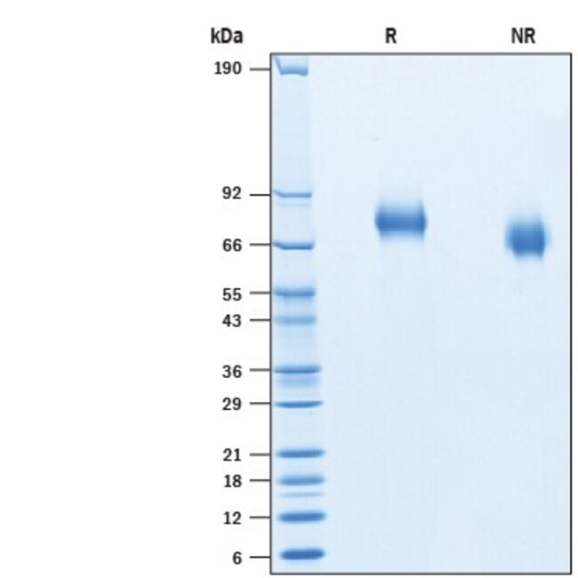 R D Systems Recombinant Human Netrin-G2 His-tag Protein 50 μg:Protéines ... R D Systems Recombinant Human Netrin-G2 His-tag Protein 50 μg:Protéines ...