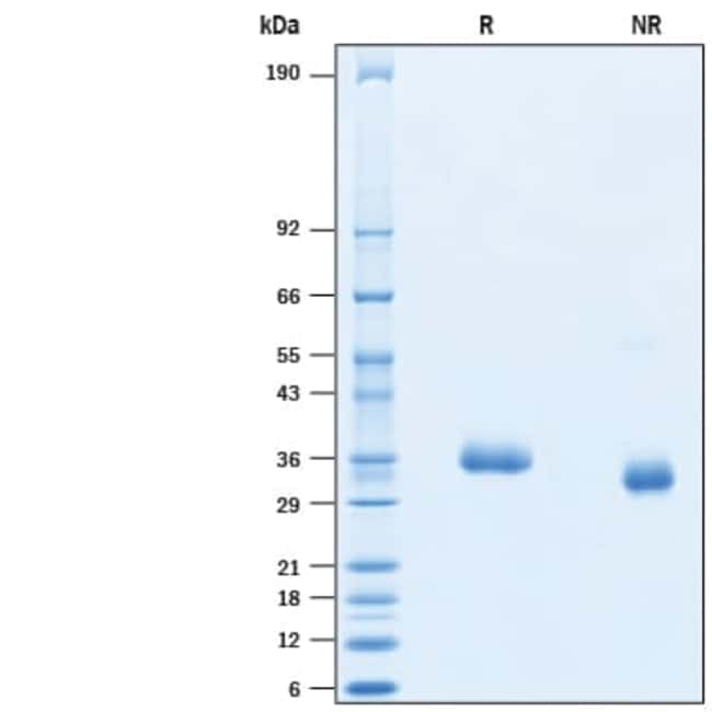R Recombinant SARS-CoV-2 E484K Spike RBD His-tag Protein, CF 100 μg ...