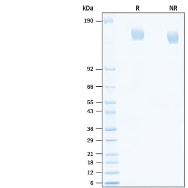 R Recombinant SARS-CoV-2 CAL.20C Spike GCN4-IZ His Protein 100 μg:Recombinant | Fisher Scientific
