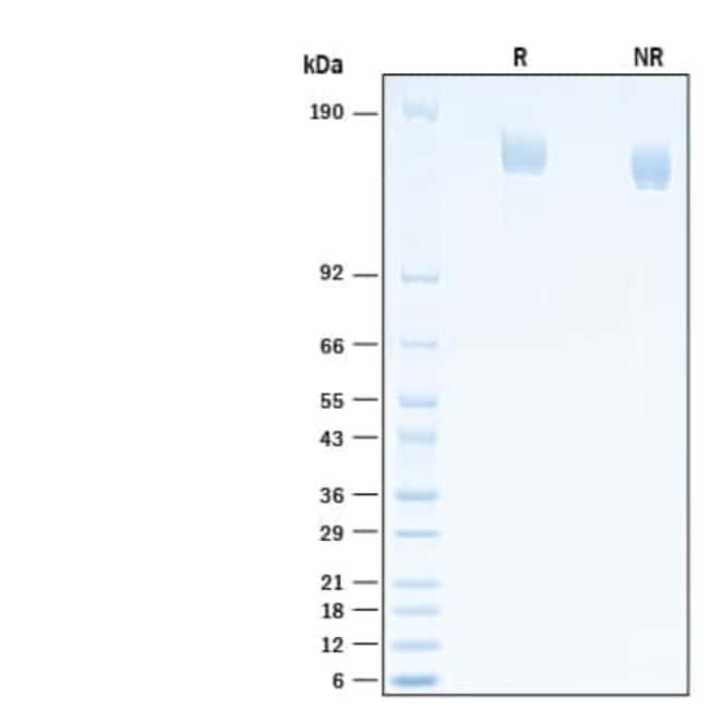 R Recombinant SARS-CoV-2 B.1.1.519 Spike GCN4-IZ Protein 100 μg:Recombinant | Fisher Scientific