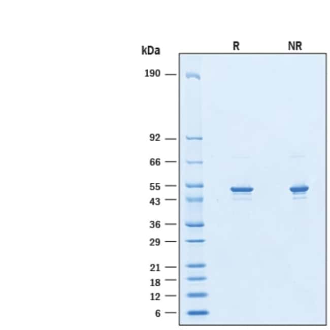 R D Systems Recombinant SARS-CoV-2 B.1.1.7 Nucleocapsid His Protein, CF | Fisher Scientific