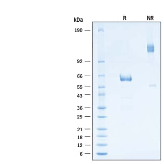 R D Systems Recombinant SARS-CoV-2 B.1.1.529 S RBD Fc Protein 100 μg:Recombinant | Fisher Scientific