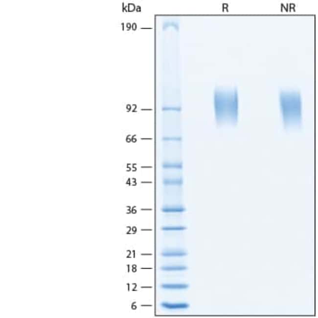 R D Systems Recombinant Mouse Mer His-tag Protein 50 μg:Proteínas ...