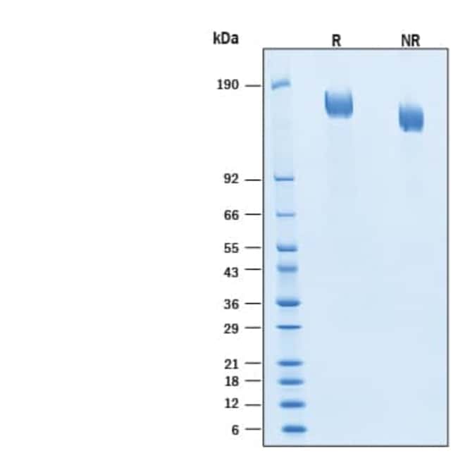 R D Systems Recombinant SARS-CoV-2 BA.2.86 Spike GCN4-IZ His Protein, CF 100 μg | Buy Online | R ...