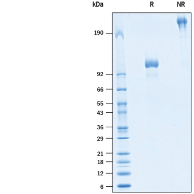 R Recombinant Human IL-12 R beta 1 Fc Avi-tag Protein 50 μg:Recombinant | Fisher Scientific