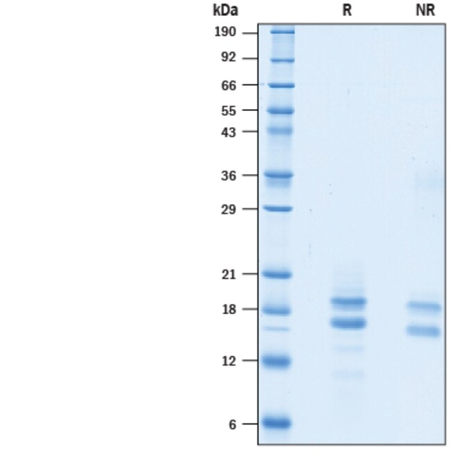 R&D Systems™ Recombinant Human Ly6H His-tag Protein 50 μg | Fisher ...