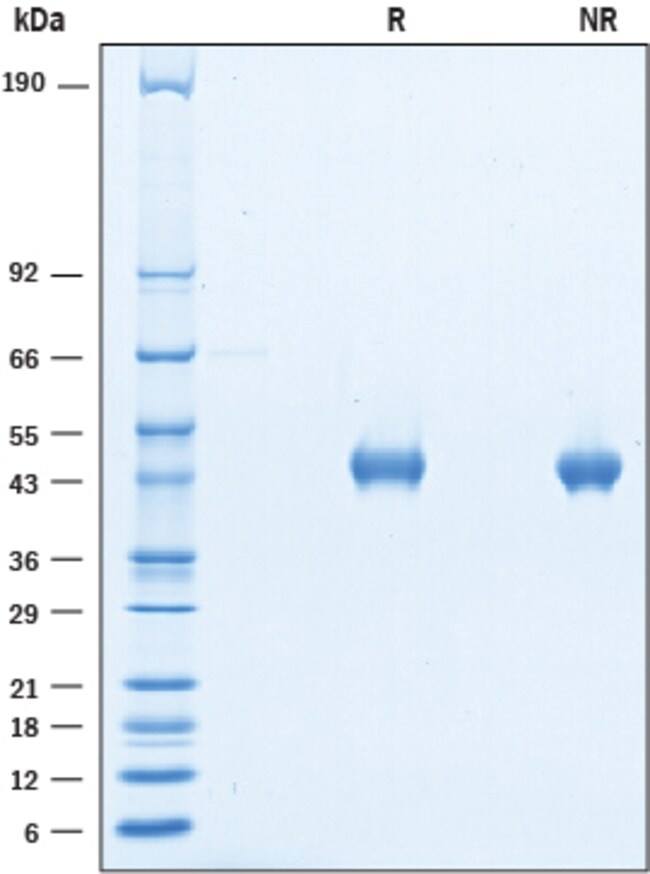 R D Systems Recombinant Mouse Neuregulin-1/NRG1 Protein 50 μg ... R D Systems Recombinant Mouse Neuregulin-1/NRG1 Protein 50 μg ...