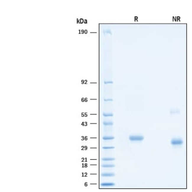 R D Systems Recombinant SARS-CoV-2 Spike RBD Alexa Fluor 488 Protein 20 | Fisher Scientific
