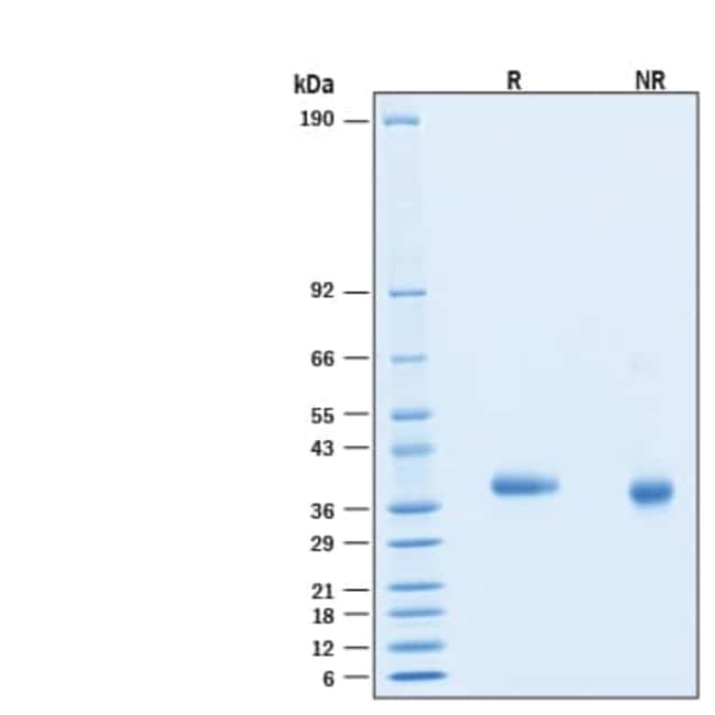 R Recombinant SARS-CoV-2 P.1 S RBD His-tag Avi-tag Protein, CF 50 μg ...