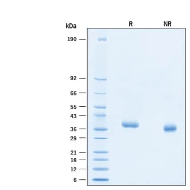R D Systems Recombinant SARS-CoV-2 C.37 Spike RBD His Avi Protein, CF ...