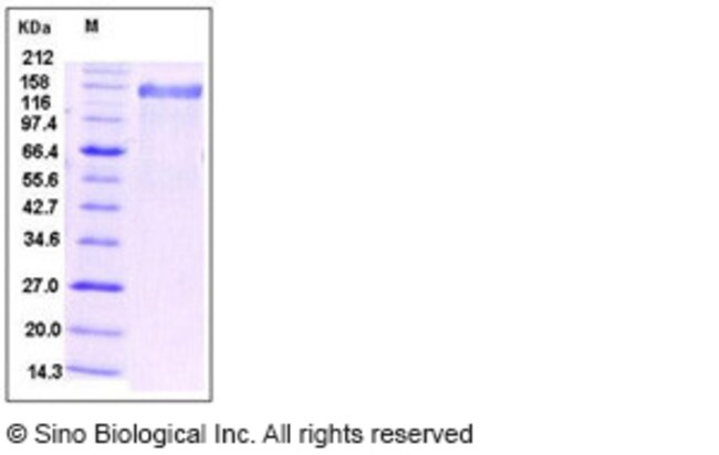 Sino Biological Human HER2 / ErbB2 Protein (Fc Tag), Biotinylated 20ug ...