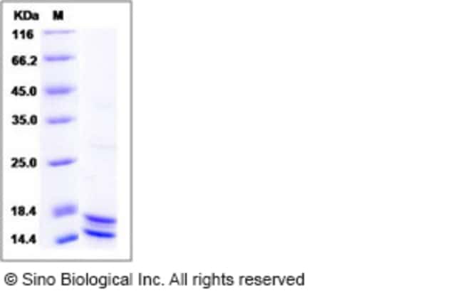 Sino Biological Human CASP3 / Caspase-3 / CASP-3 Protein (His Tag ...