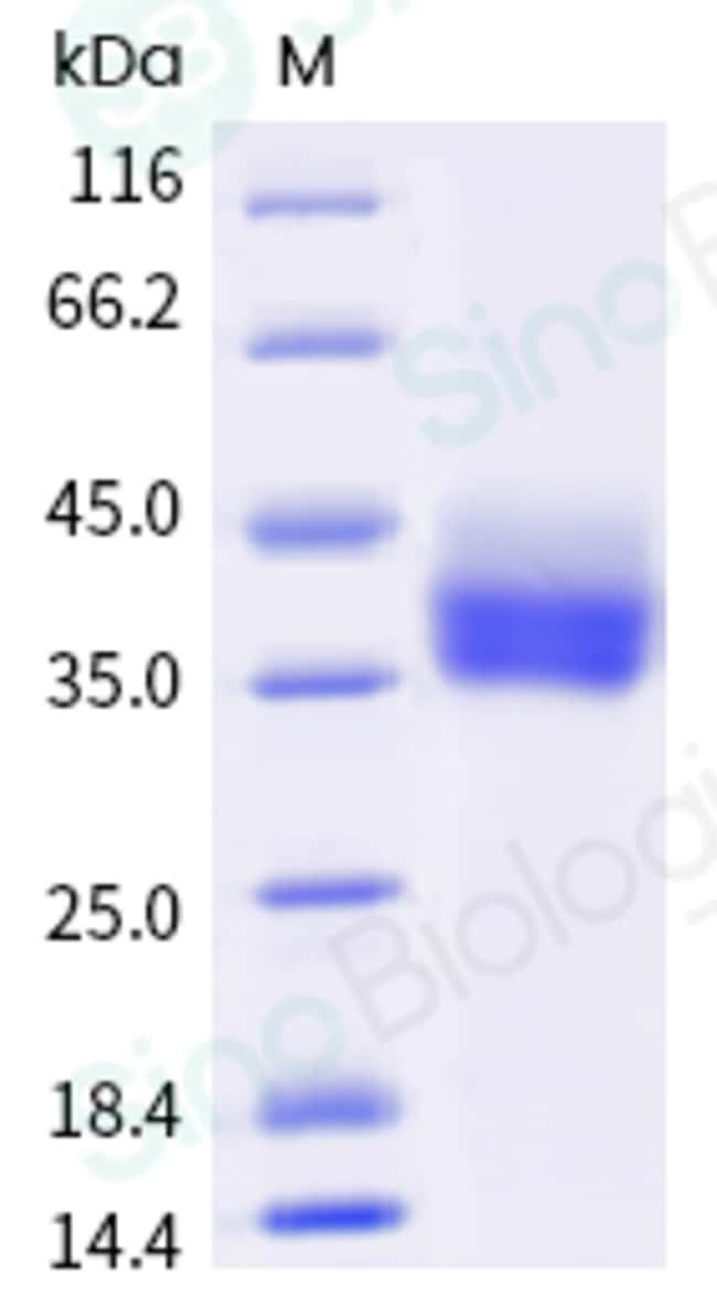 Sino Biological Human PD-L1 Protein (His & AVI Tag), Biotinylated 100ug ...