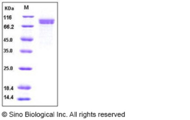 Sino Biological Human Cadherin-8 / CDH8 Protein (His Tag) 50ug ...