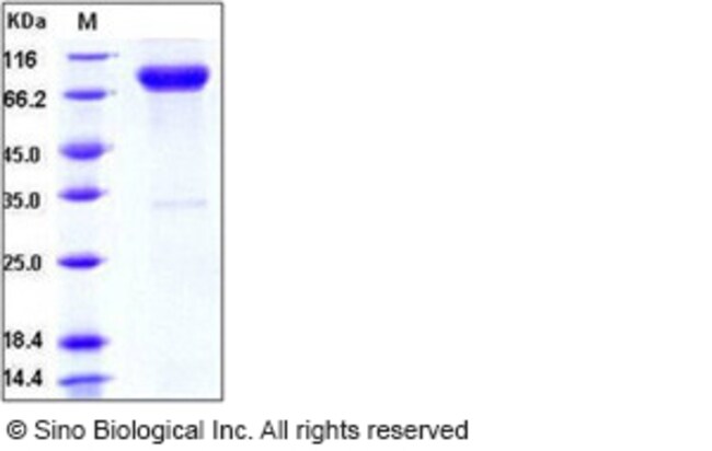 Sino Biological Human IL-1R8 / IL1RAPL1 Protein (Fc Tag) 1mg | Fisher ...