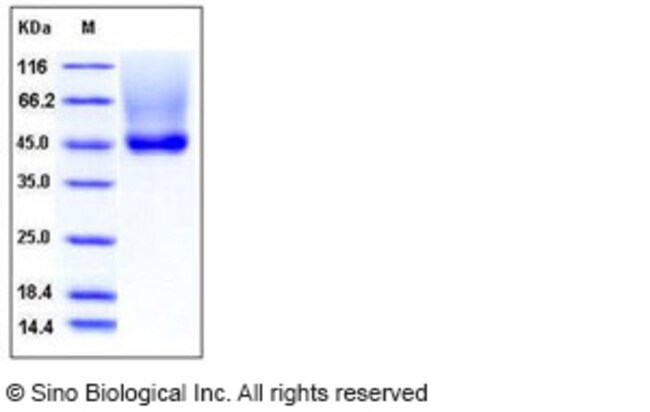 Sino Biological Human Decorin / DCN / SLRR1B Protein (His Tag) 1mg ...