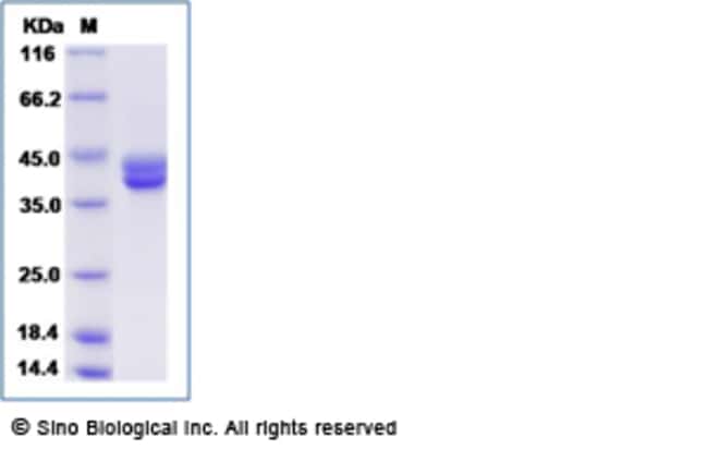 Sino Biological Human Decorin / DCN Protein 1mg, Quantity: Each of 1 ...