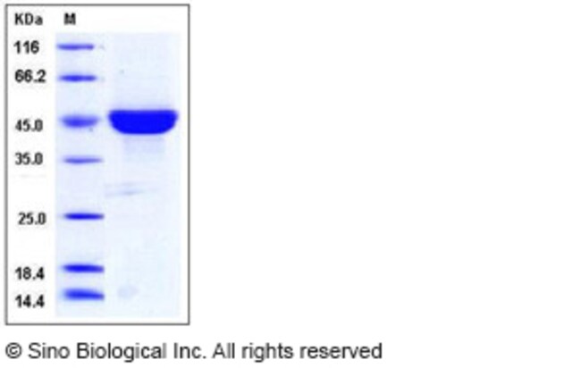 Sino Biological Human CD40L / CD154 / TNFSF5 Protein (ECD, Fc Tag ...