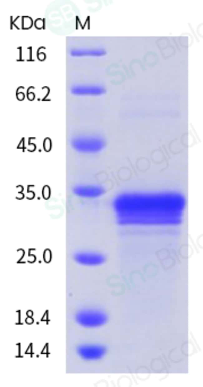 Sino Biological Human HMGB1 / HMG1 Protein (His Tag) 500ug, Quantity ...