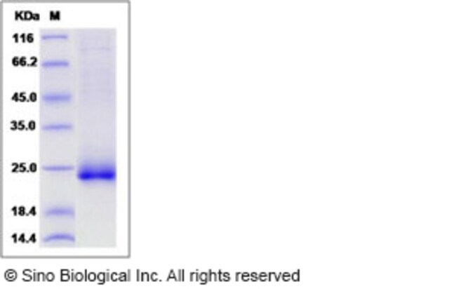 Sino Biological Human IFN omega 1 / IFNW1 Protein (His Tag) 1mg ...