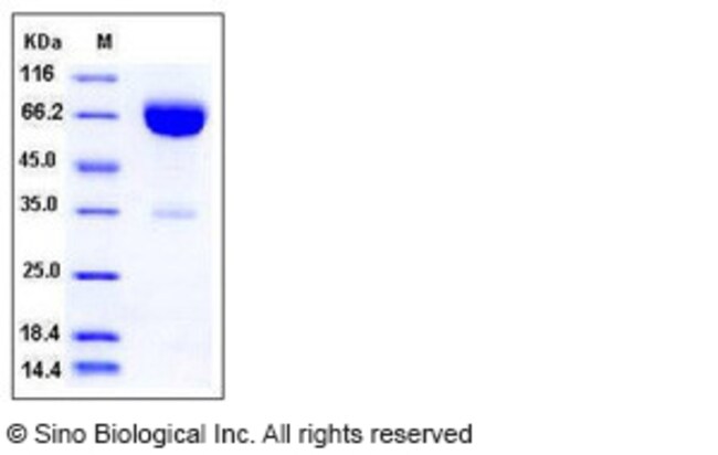 Sino Biological Human IFNAR2 / IFNABR Protein (Fc Tag) 1mg, Quantity ...