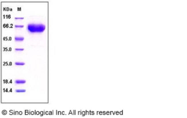 Sino Biological Human PD1 / PDCD1 Protein (His & Fc Tag), Quantity ...