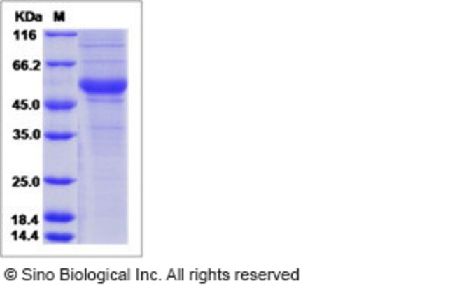 Sino Biological Human Thrombopoietin / THPO Protein (Fc Tag) 1mg ...