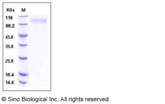 Sino Biological Human Thrombopoietin / THPO / TPO Protein (His Tag ...