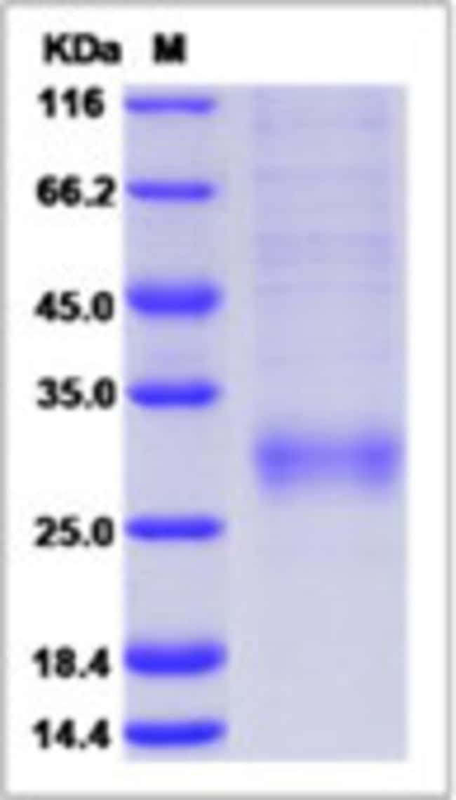 Sino Biological Human THPO Protein 1MG (Sino Biological), Quantity ...