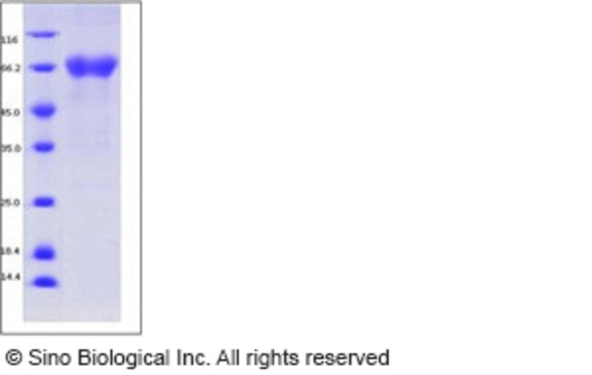 Sino Biological Human TIM-3 / HAVCR2 Protein (ECD, His & Fc Tag ...