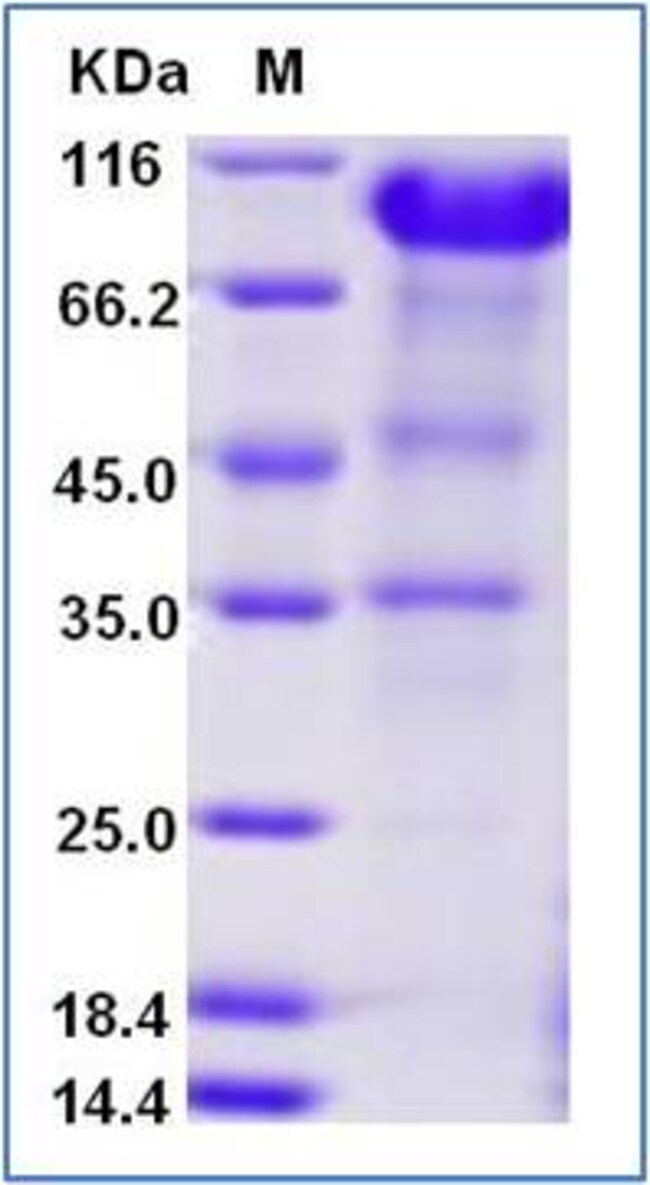 Sino Biological Human IL-6R Protein (Fc & AVI Tag), Biotinylated 100ug ...