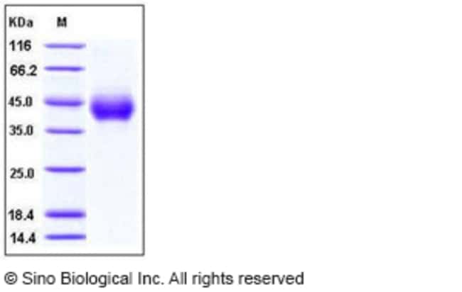 Sino Biological Human TNFR2 / CD120b / TNFRSF1B Protein (ECD, His Tag ...