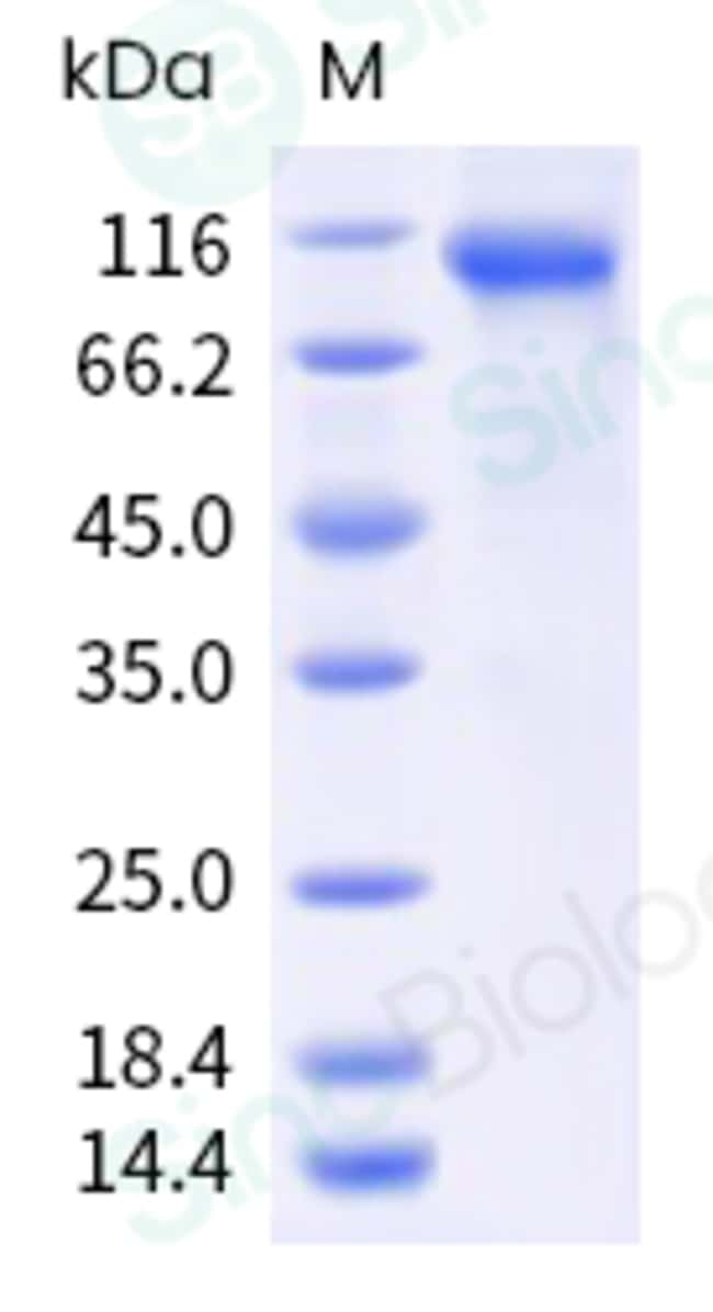 Sino Biological Human FLT3 Protein (ECD, Fc Tag), Quantity: Each of 1 ...