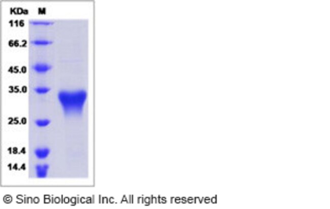 Sino Biological Human Oncostatin M / OSM Protein 1mg, Quantity: Each of ...