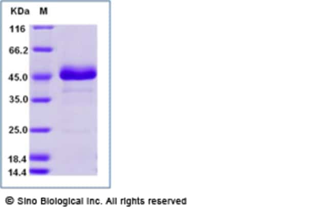 Sino Biological Human TRAIL R2 / CD262 / TNFRSF10B Protein (Fc Tag) 1mg ...