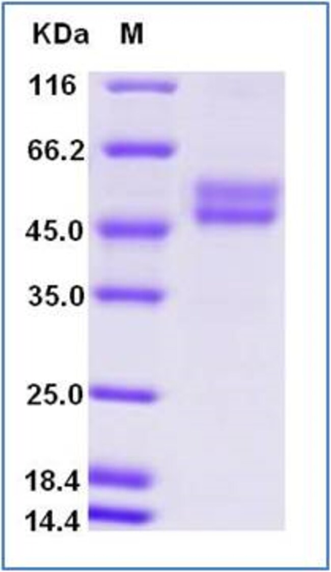 Sino Biological Human Frizzled 5 / FZD5 Protein (Fc Tag), Quantity ...
