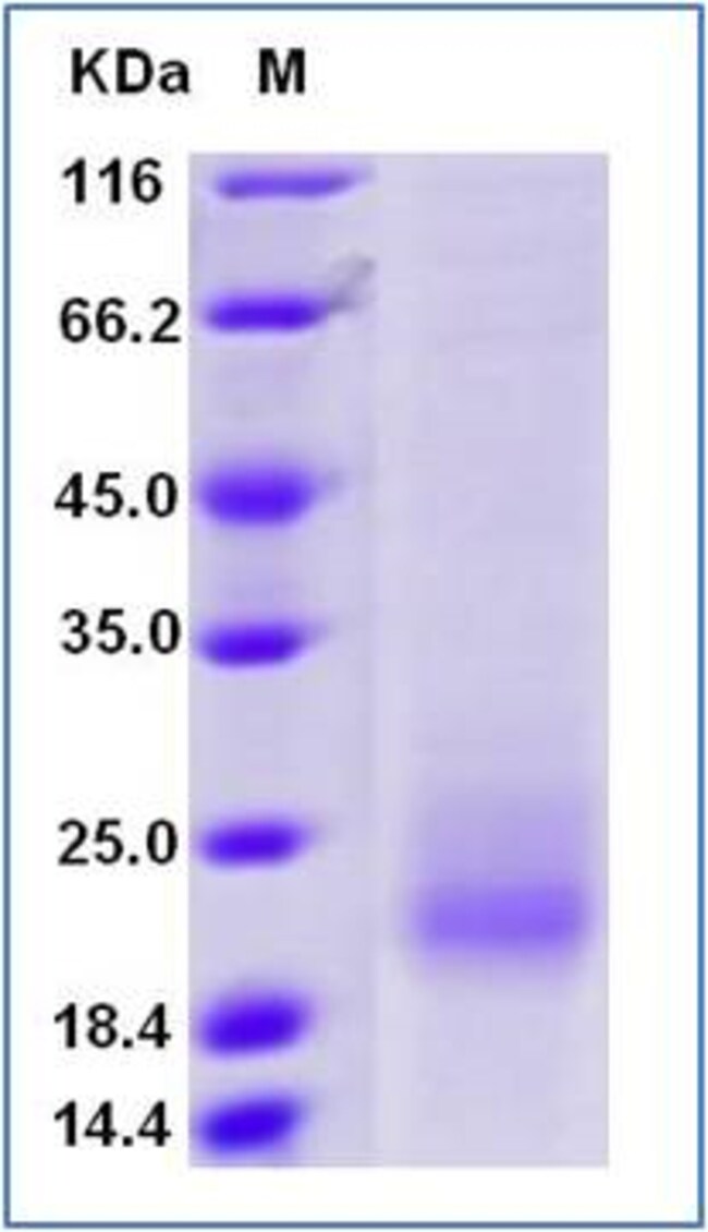 Sino Biological Human VEGF-D / VEGFD / FIGF Protein (His Tag), Quantity ...