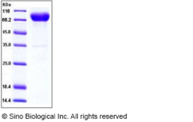 Sino Biological Human CD226 / DNAM-1 Protein (His & Fc Tag ...