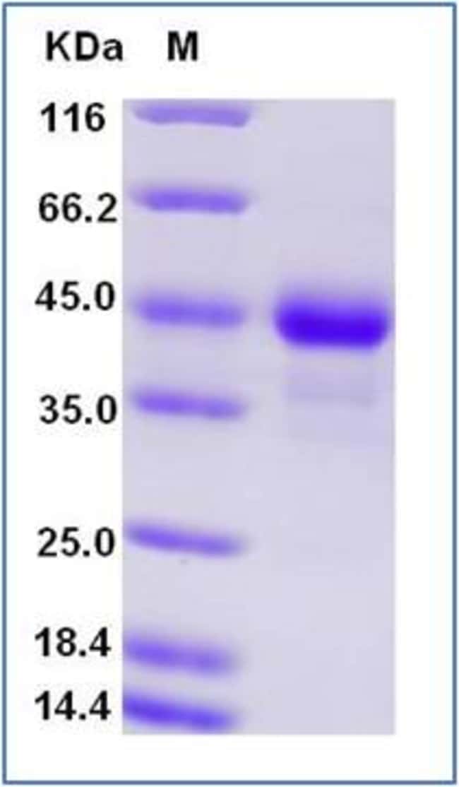 Sino Biological Human ALK4/ACVR1B Protein (Fc Tag) 200ug, Quantity ...