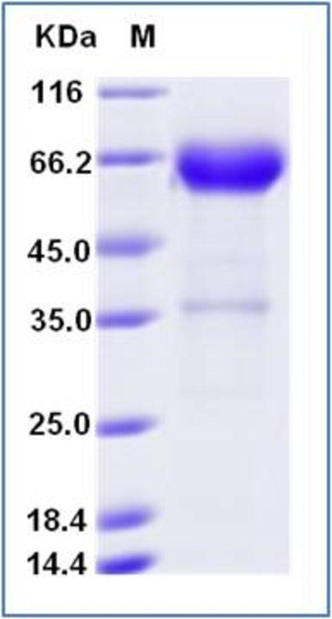 Sino Biological Human EpCAM Protein (Fc & AVI Tag), Biotinylated 20ug ...