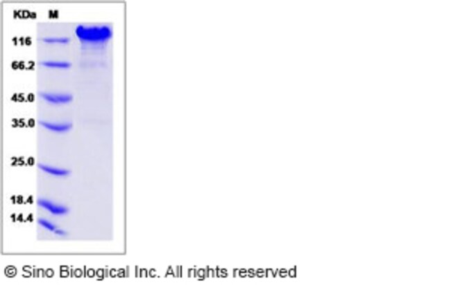Sino Biological Human Neuropilin 2 / NRP2 Protein (Fc Tag) 1mg ...