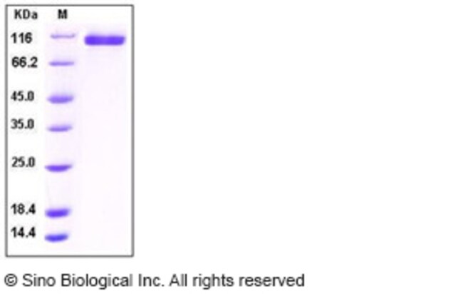 Sino Biological Human Neuropilin-2 / NRP2 Protein (His Tag) | Fisher ...
